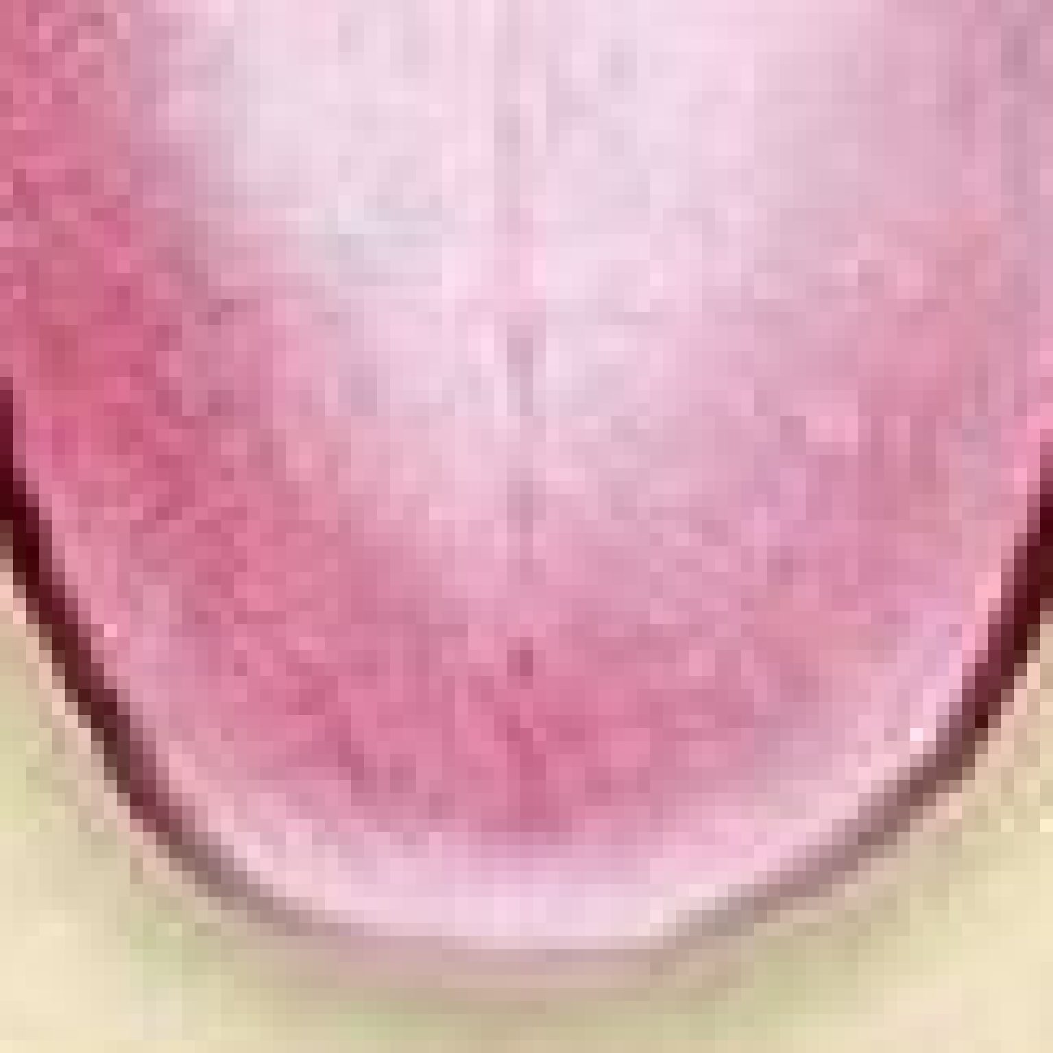 Is the color of my tongue healthy or unhealthy? - MeNovating