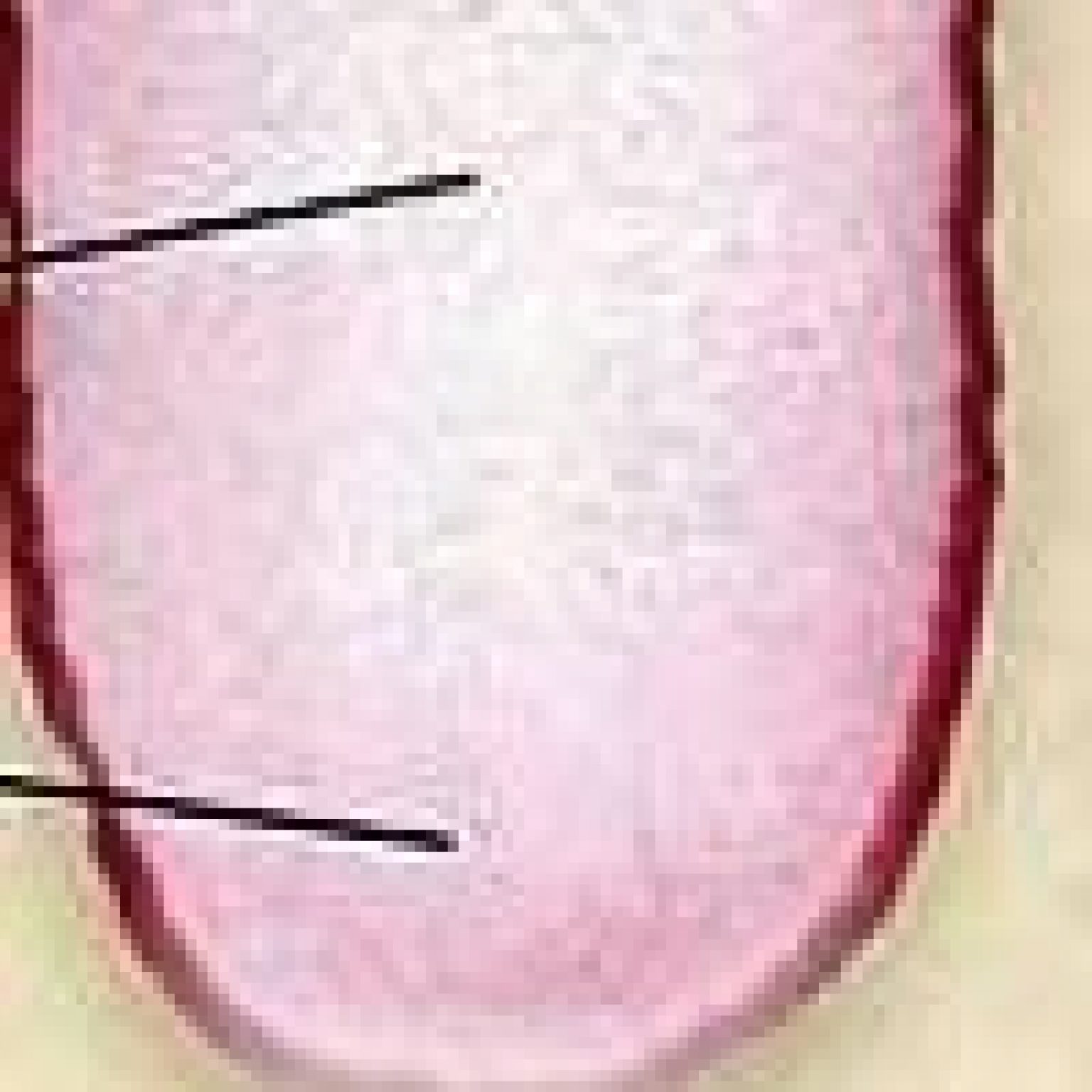 Foods to Cure Unhealthy Tongue Color - MeNovating