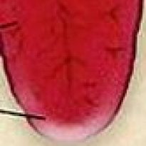 Is the color of my tongue healthy or unhealthy? - MeNovating